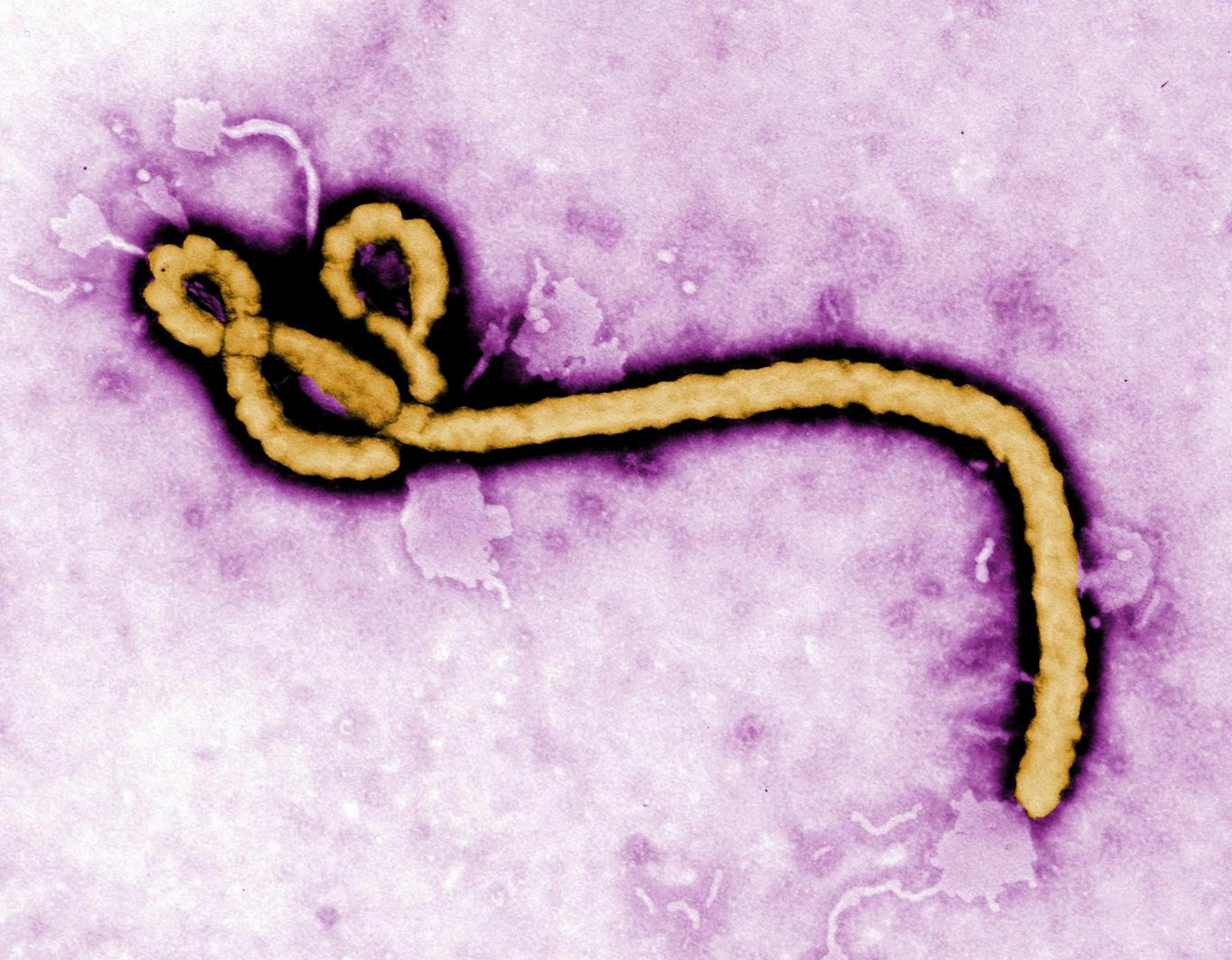 Explainer: What is a virus?