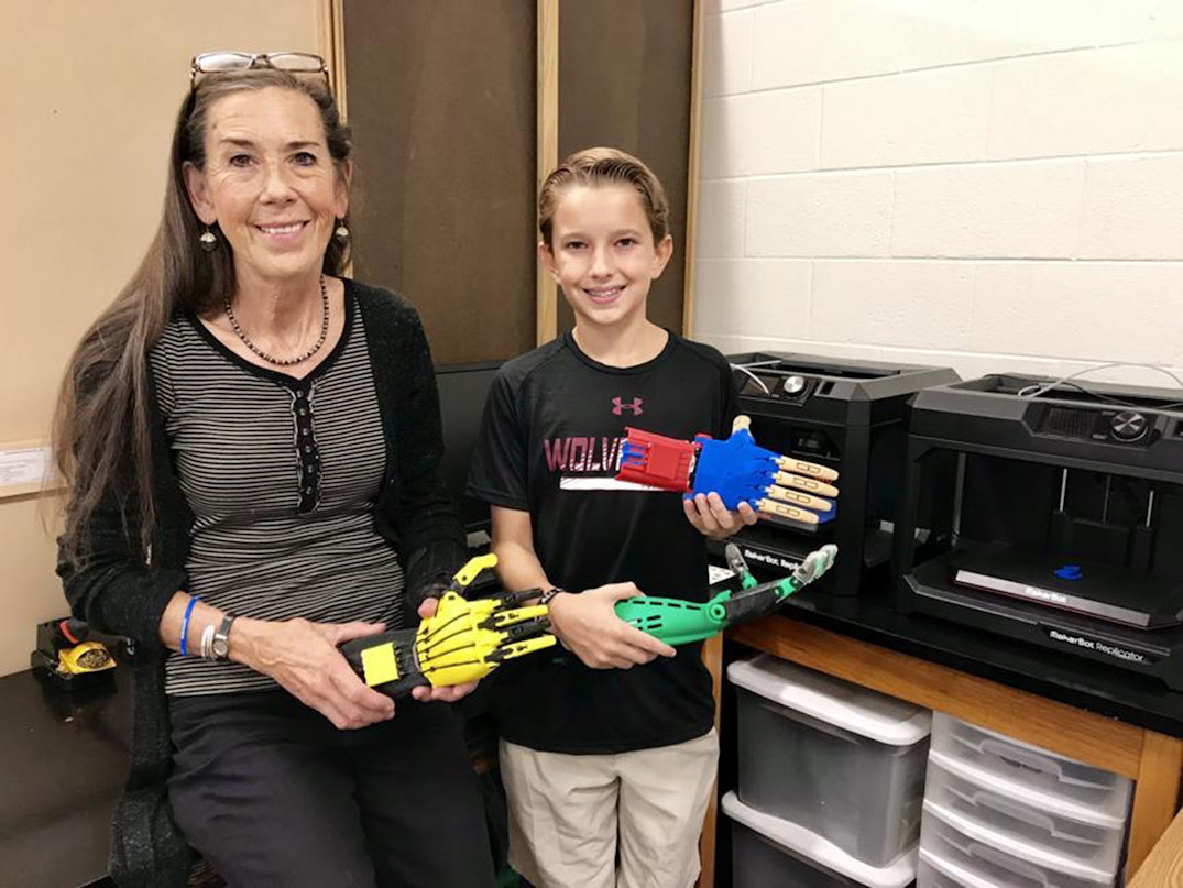 Student creates robotic arm for man who lost limbs from infection